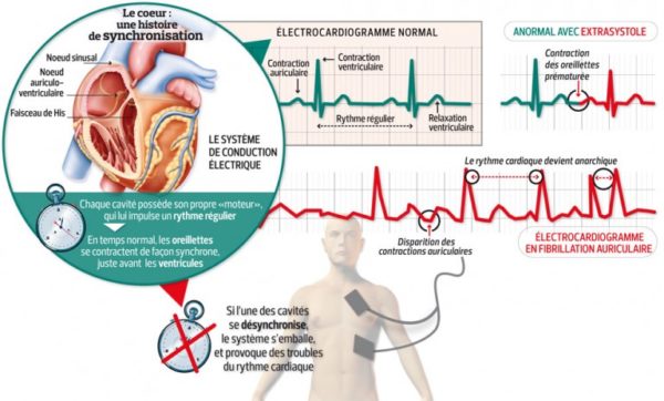 Problèmes cardiaques et pulmonaires - Physio Vevey